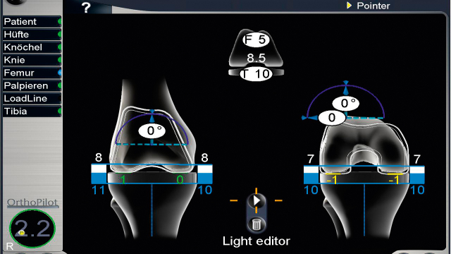 OrthoPilot® - navigační systém u operací kloubů | Lepší péče